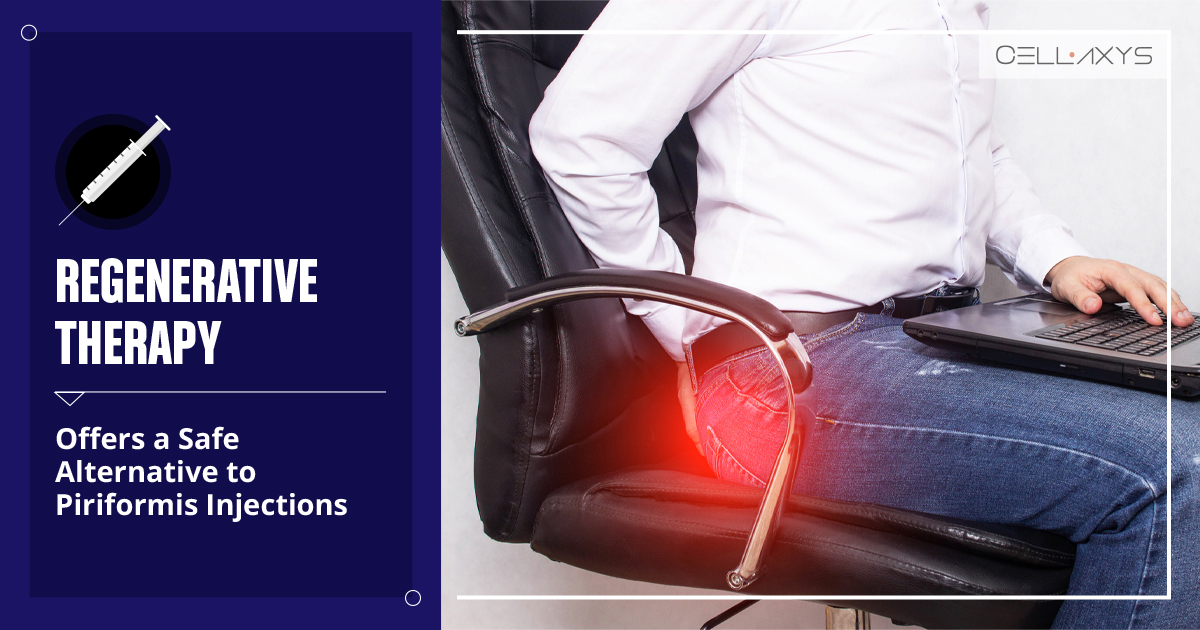 Regenerative Therapy Offers A Safe Alternative To Piriformis Injections ...