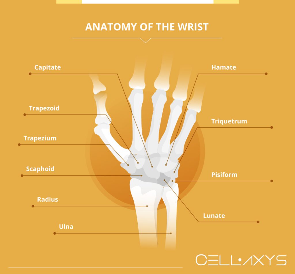 Ulnar Wrist Pain: Why Ulnar Shortening Osteotomy Is Not Ideal - Cellaxys