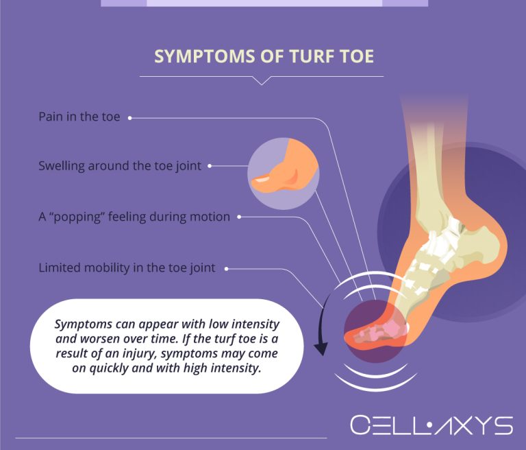 How To Minimize Turf Toe Recovery Time - Cellaxys