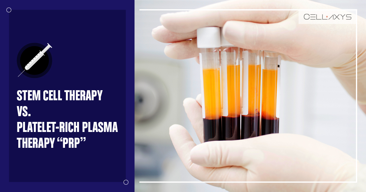 Stem Cell Therapy Vs Platelet Rich Plasma Therapy “prp” Cellaxys