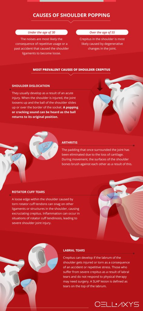 Causes Of Popping Noise In The Shoulder - Cellaxys