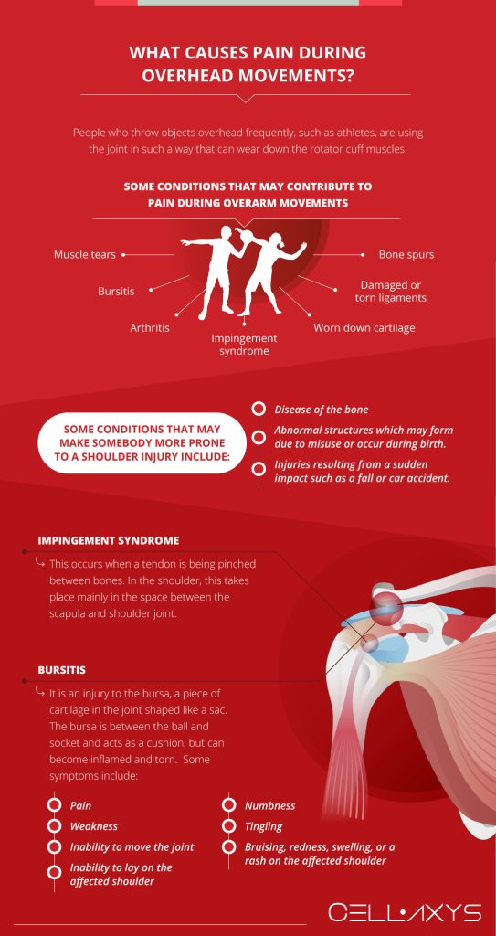 Why Overhead Arm Movements May Cause Pain - Cellaxys