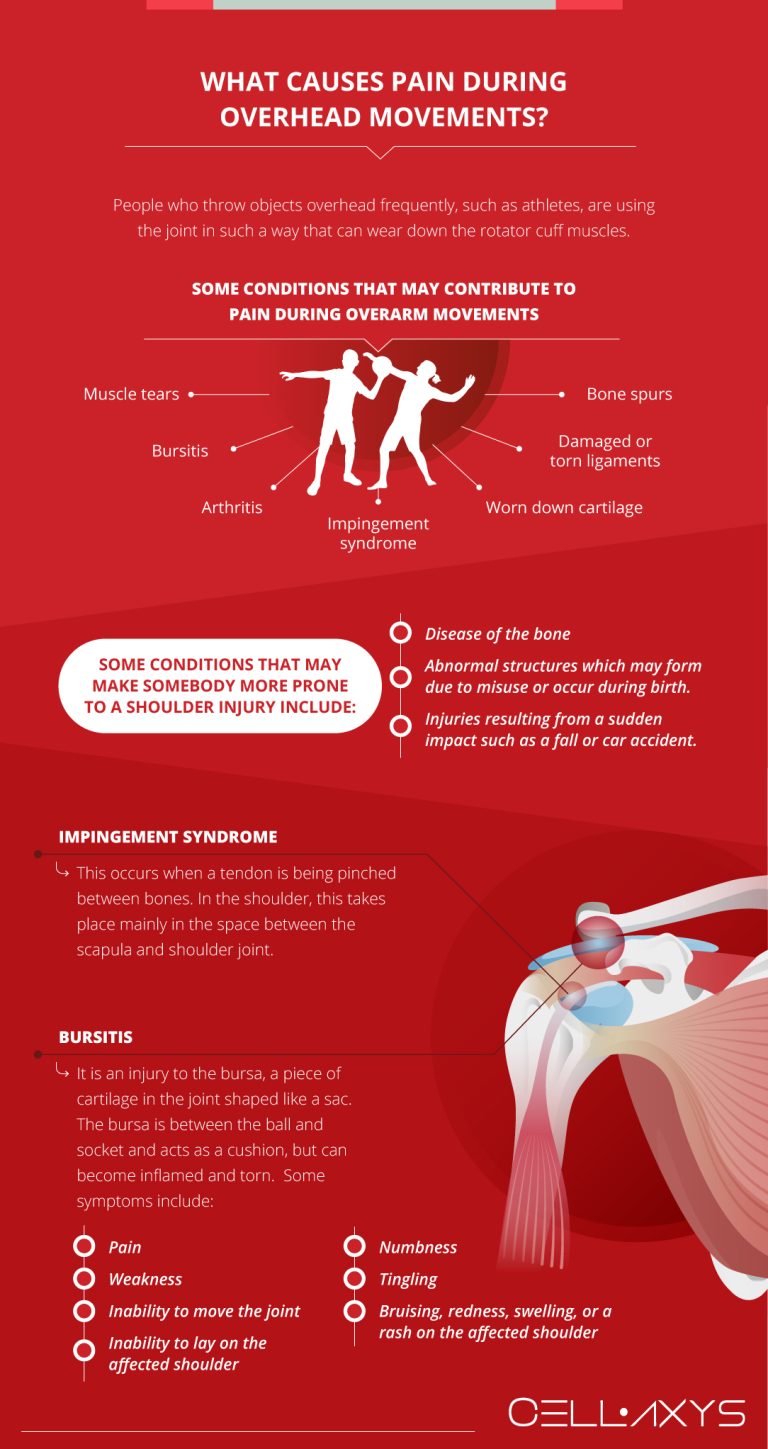 Why Overhead Arm Movements May Cause Pain - Cellaxys