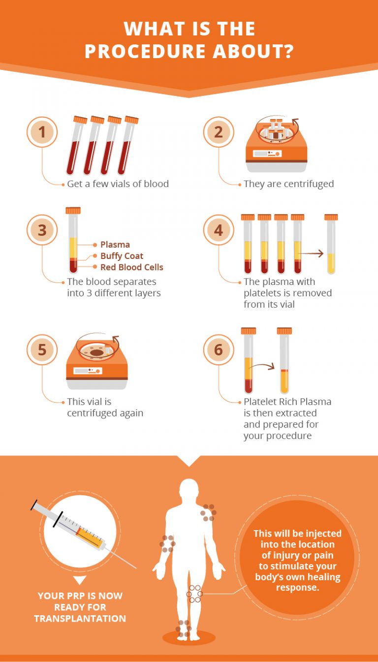 Platelet Rich Plasma Therapy - Cellaxys