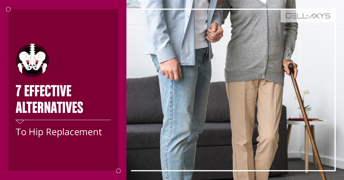 7 Effective Alternatives To Hip Replacement Cellaxys