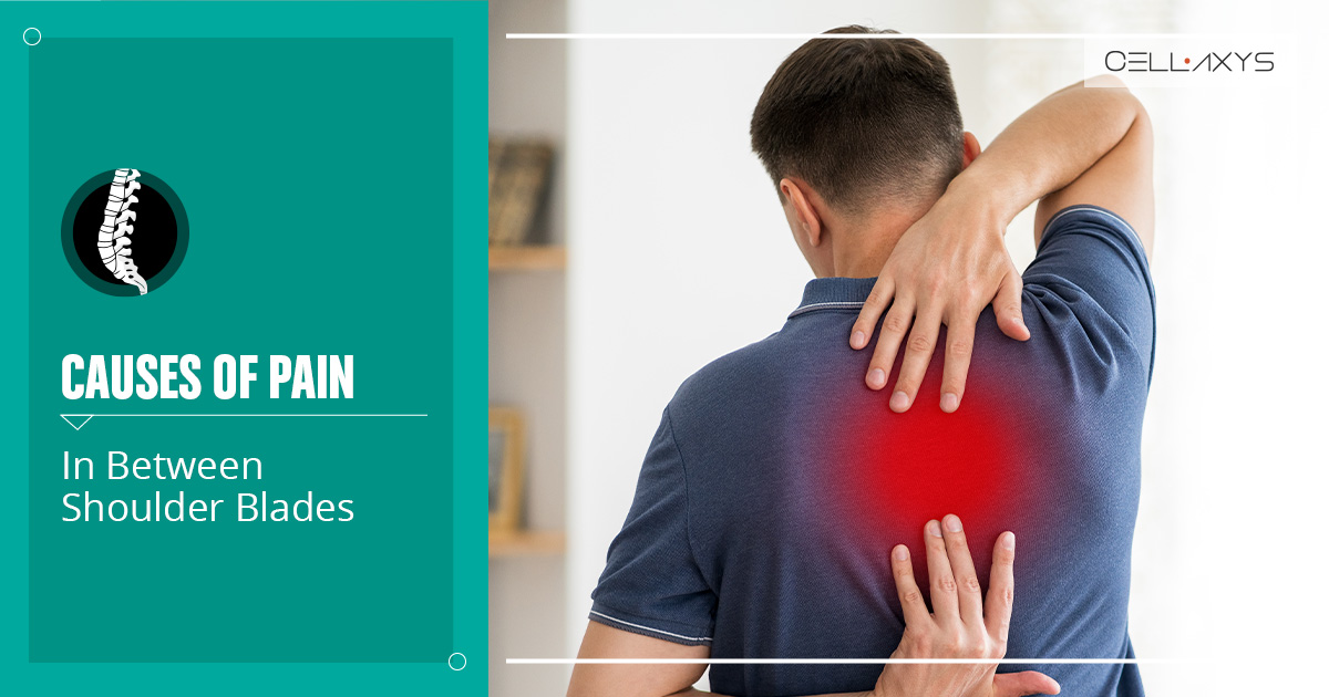 12 Causes Of Pain In Between Shoulder Blades Cellaxys