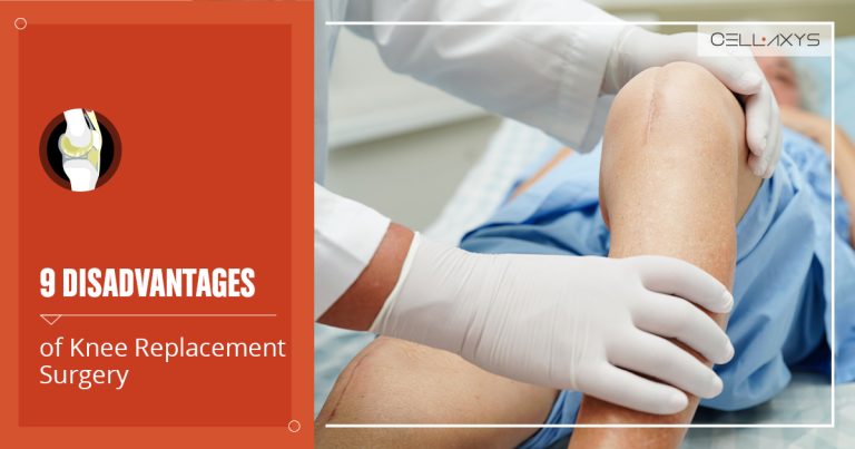 Knee Replacement Recovery Time - Cellaxys