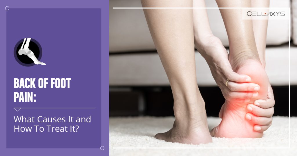 Navicular Bone Pain: Causes And Treatment - Cellaxys