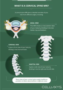 Normal Vs Abnormal Cervical Spine MRI: What Are The Differences? - Cellaxys