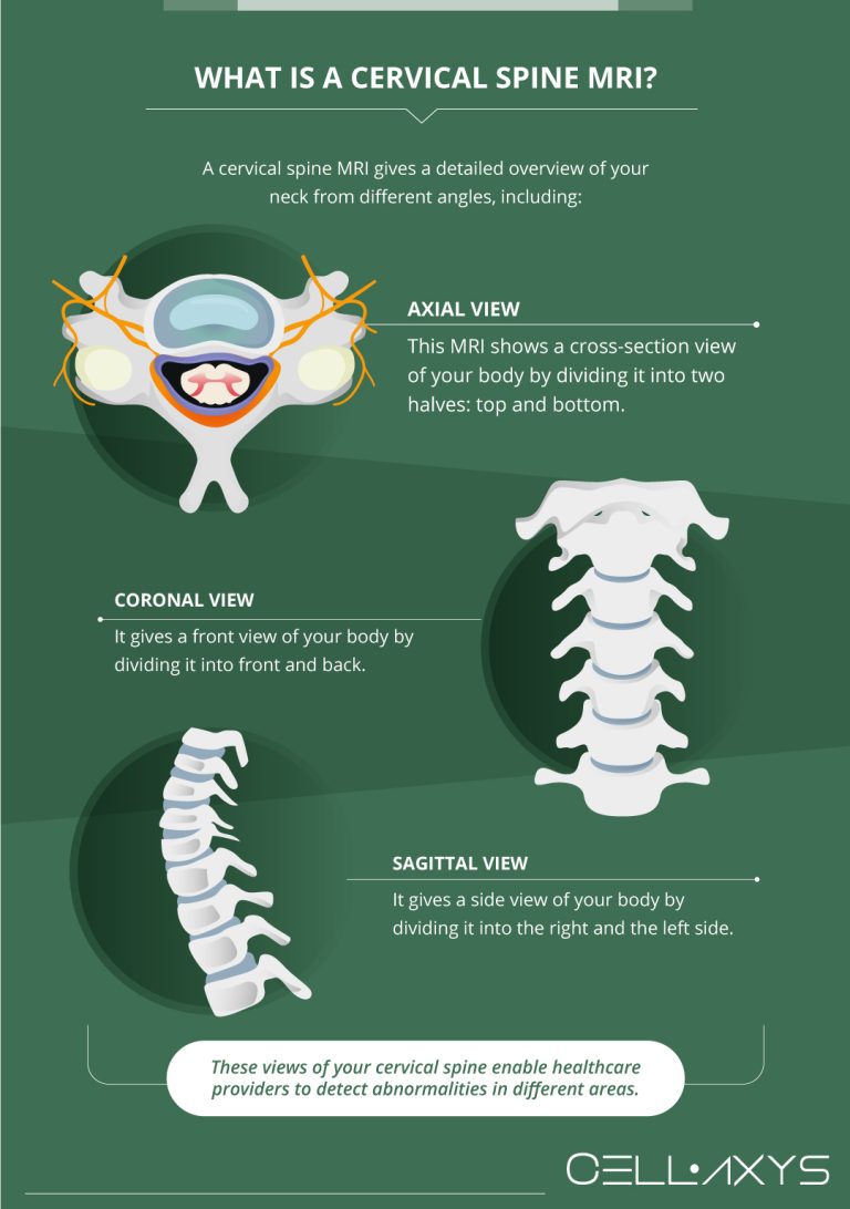 Normal Vs Abnormal Cervical Spine MRI: What Are The Differences? - Cellaxys