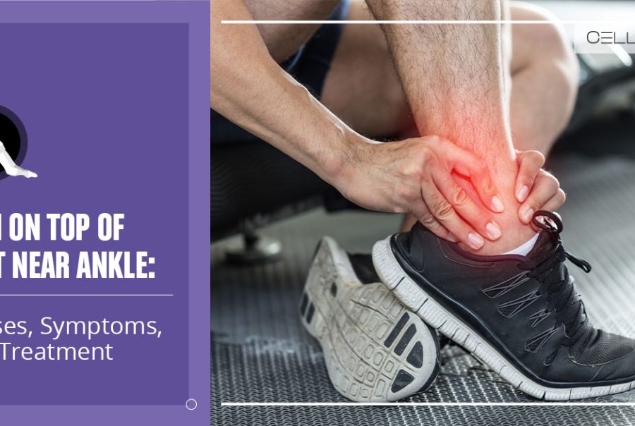 Back Of Foot Pain: What Causes It And How To Treat It? - Cellaxys
