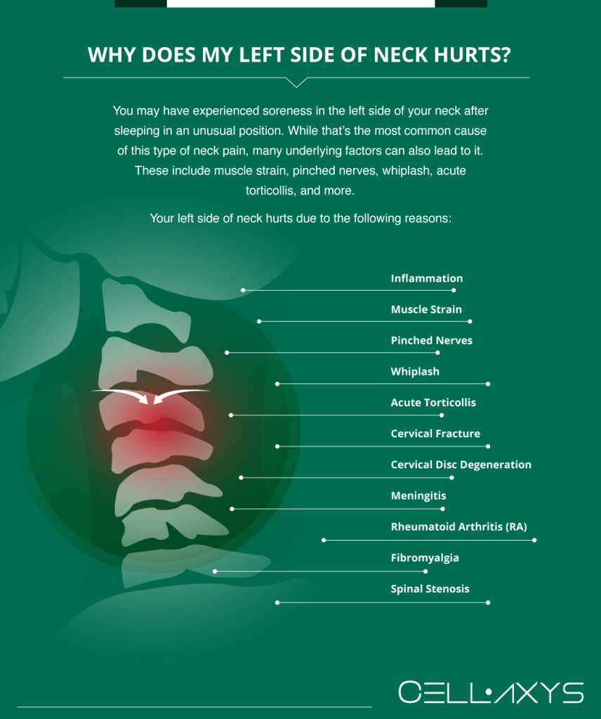 Why Does My Left Side Of Neck Hurts? - Cellaxys