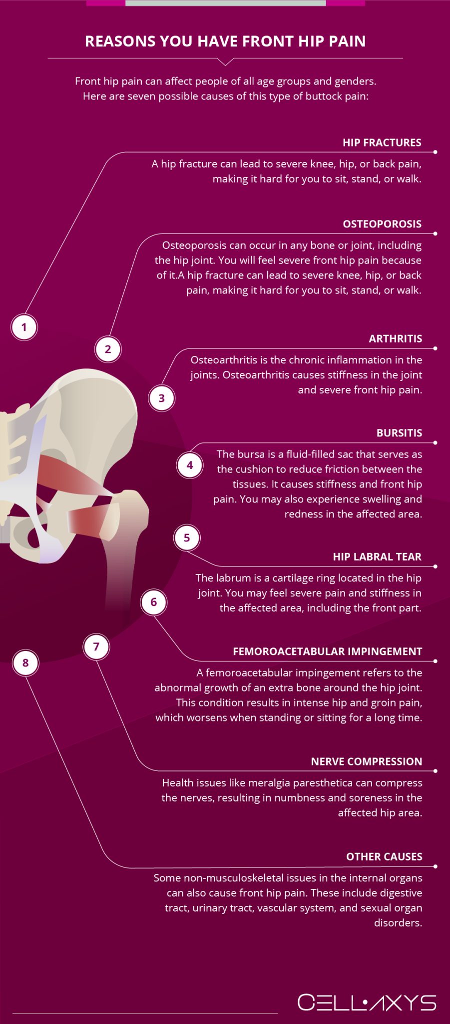 What Causes Front Hip Pain And How To Treat It - Cellaxys