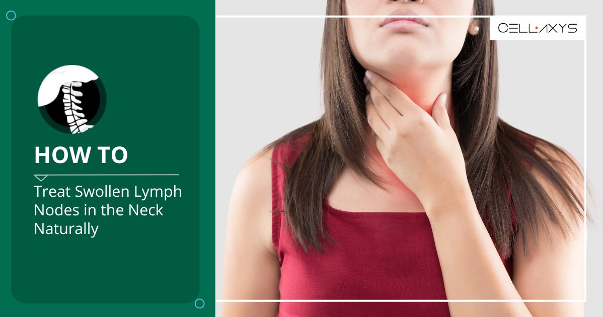 How To Treat Swollen Lymph Nodes In The Neck Naturally - Cellaxys