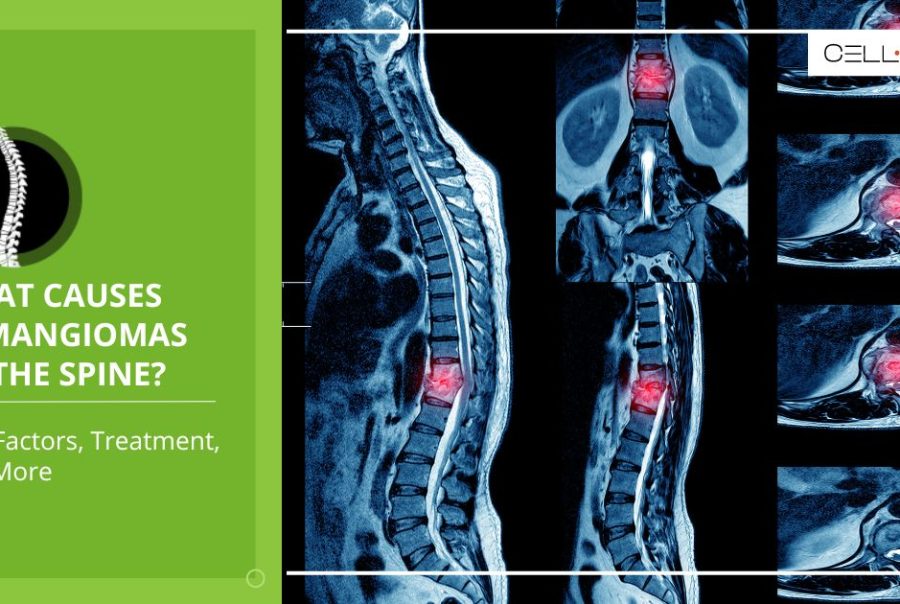 Causes And Treatment Of Tender Spot On Spine When Pressed - Cellaxys