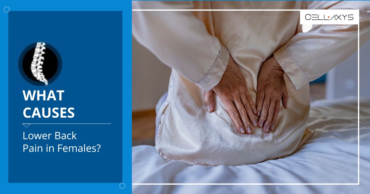 What Causes Lower Back Pain In Females? - Cellaxys