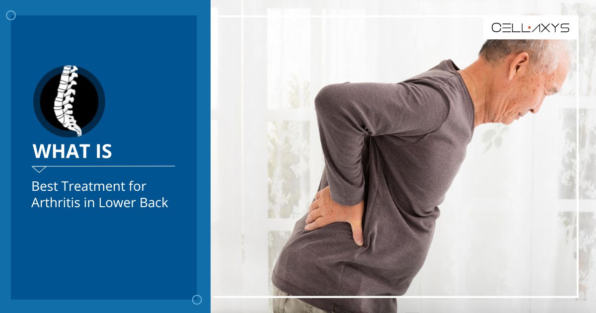 What Is Best Treatment For Arthritis In Lower Back - Cellaxys